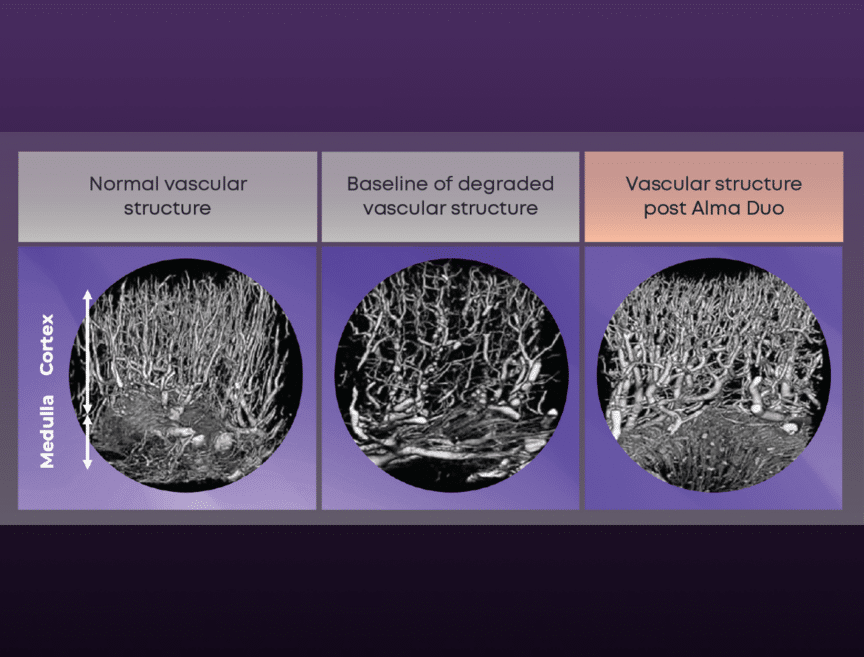 2022 Alma Duo Vascular Structure Non-Invasive Shock Wave Therapy Device ...