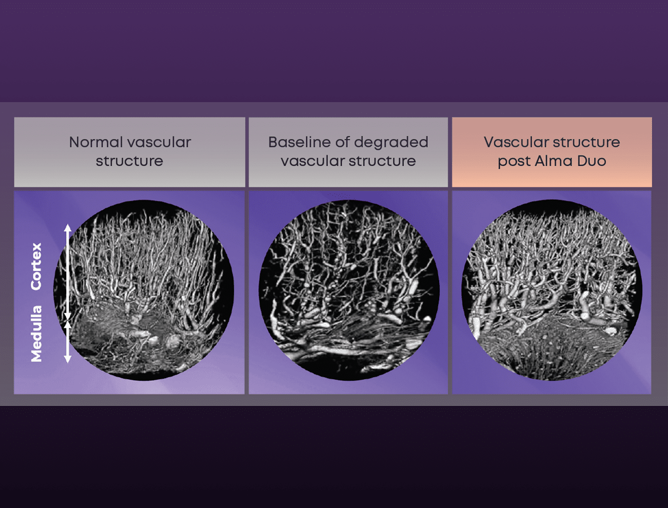 2022 Alma Duo Vascular Structure Non-Invasive Shock Wave Therapy Device ...